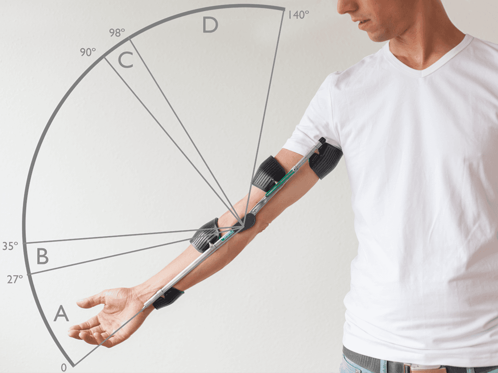 Wilmer Elbow Orthosis • Ambroise