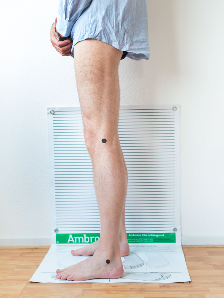 Fotomaatname UTX Genux beenorthese • Ambroise